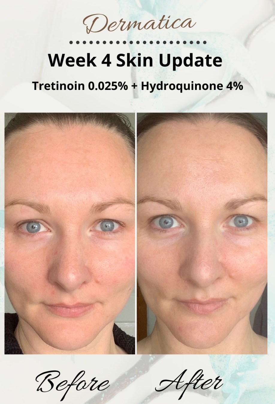 Dermatica – My Journey – Beauty and the Ballroom